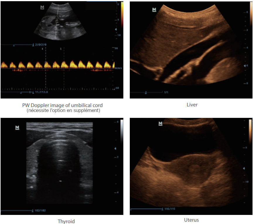 Echographe numérique portable à ultrasons Mindray DP-10