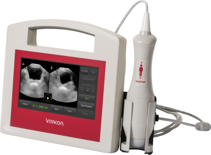 Scanner vésical Vitascan Vitacon