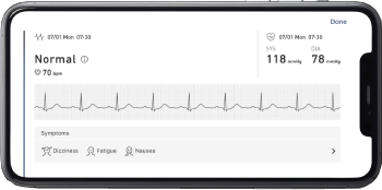 Tensiomètre électronique au bras Complete HEM-7530T-E3 avec fonction ECG Omron