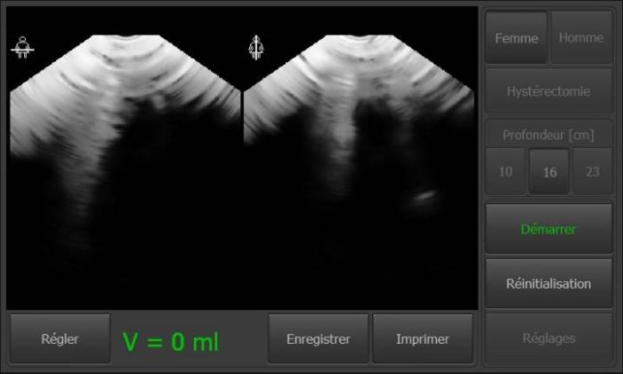 Bladder scanner / Scanner vésical USB Vitascan LT
